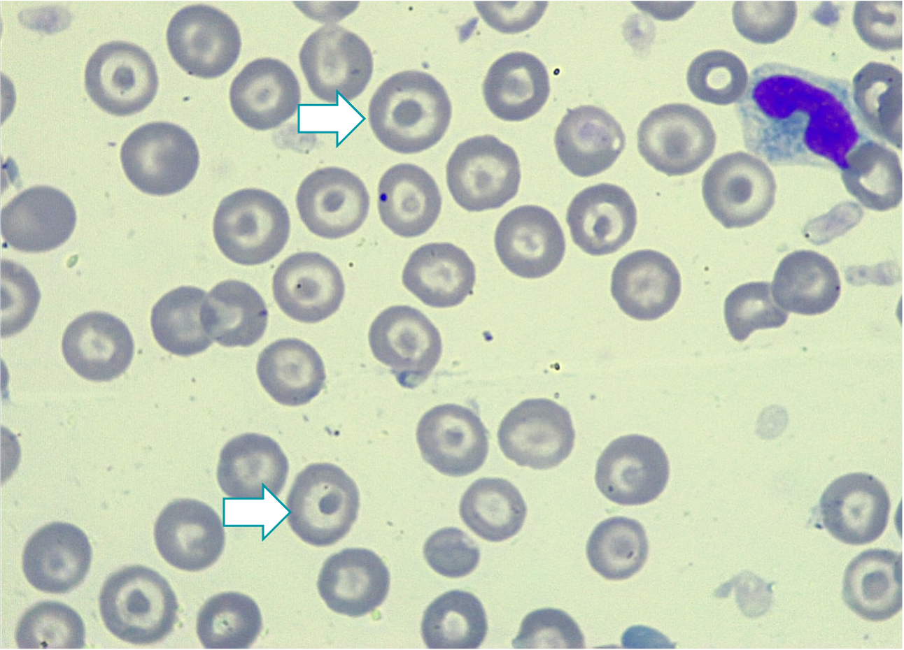 3. Eritrocitos: Poiquilocitosis – Patología Clínica Veterinaria